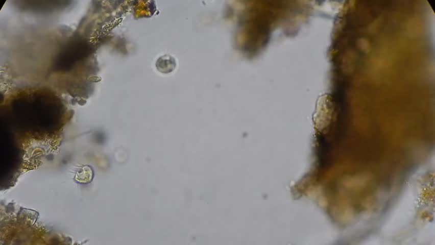 Heliozoa Or Sun Animalcule Under Microscope, Magnif 400x Stock Footage ...