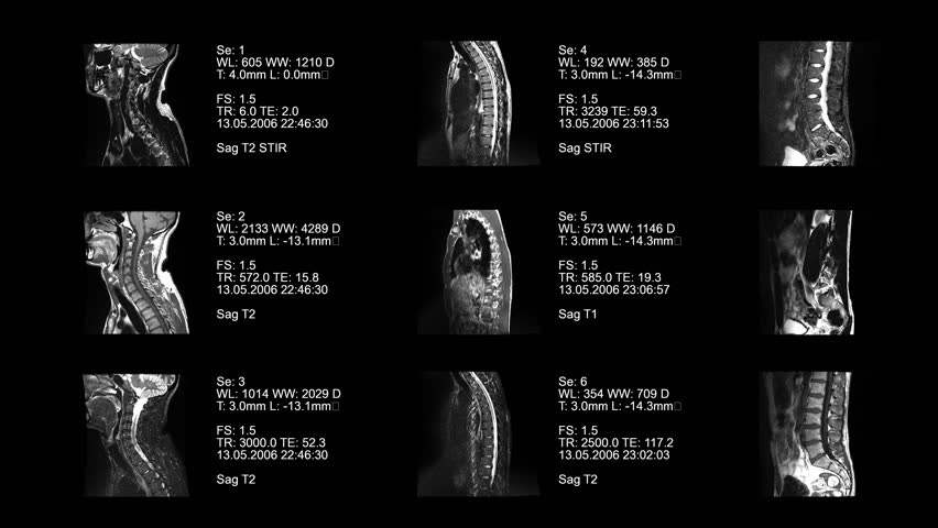 4k Blue Medical Background. Video Showing MRI, Charts, Numbers And Data ...