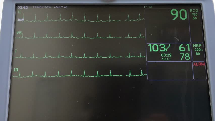 Heartbeat Monitor Screen. ECG Monitor Displays Heart Pulse, Oxygen ...