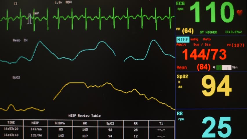 Hospital. The Medical Computer Screen Of The Scanner Supervising Human ...