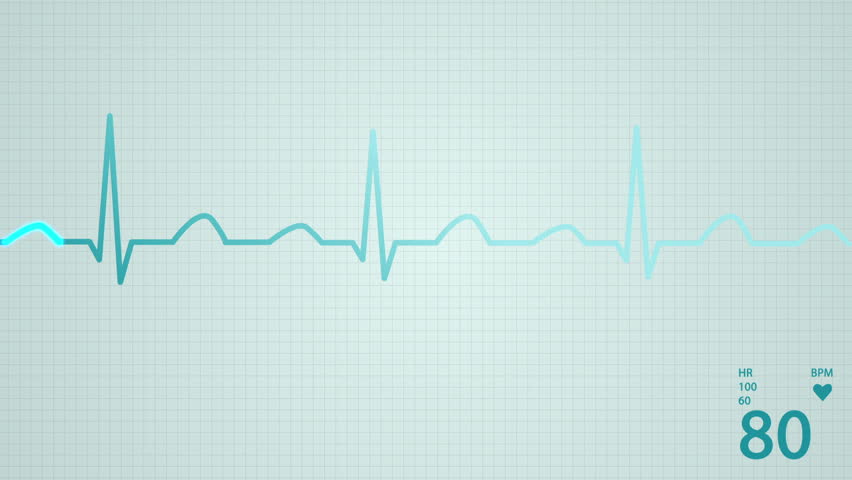 Animation Of Schematic Diagram Of Normal Sinus Rhythm For A Human Heart ...