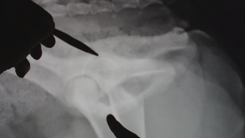 Veterinarian Explaining Radiograph To A Pet Owner. This Is A Fairly ...