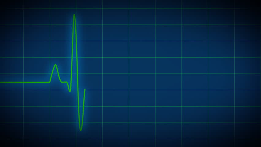 Medical Background With A Heart Beat Pulse With A Heart Rate Monitor ...