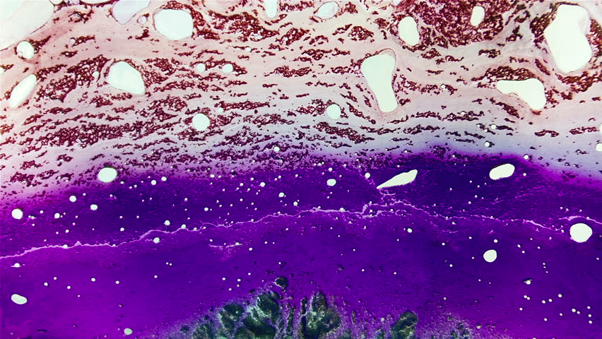 Escherichia Coli Bacteria (E. Coli) Under Microscope, Magnification ...